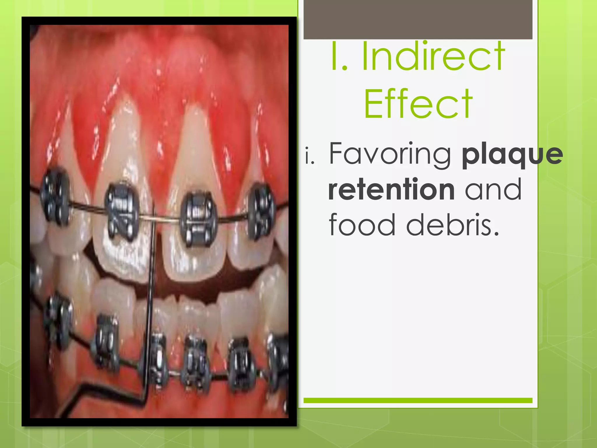 Iatrogenic factors in periodontal disease | PPTX
