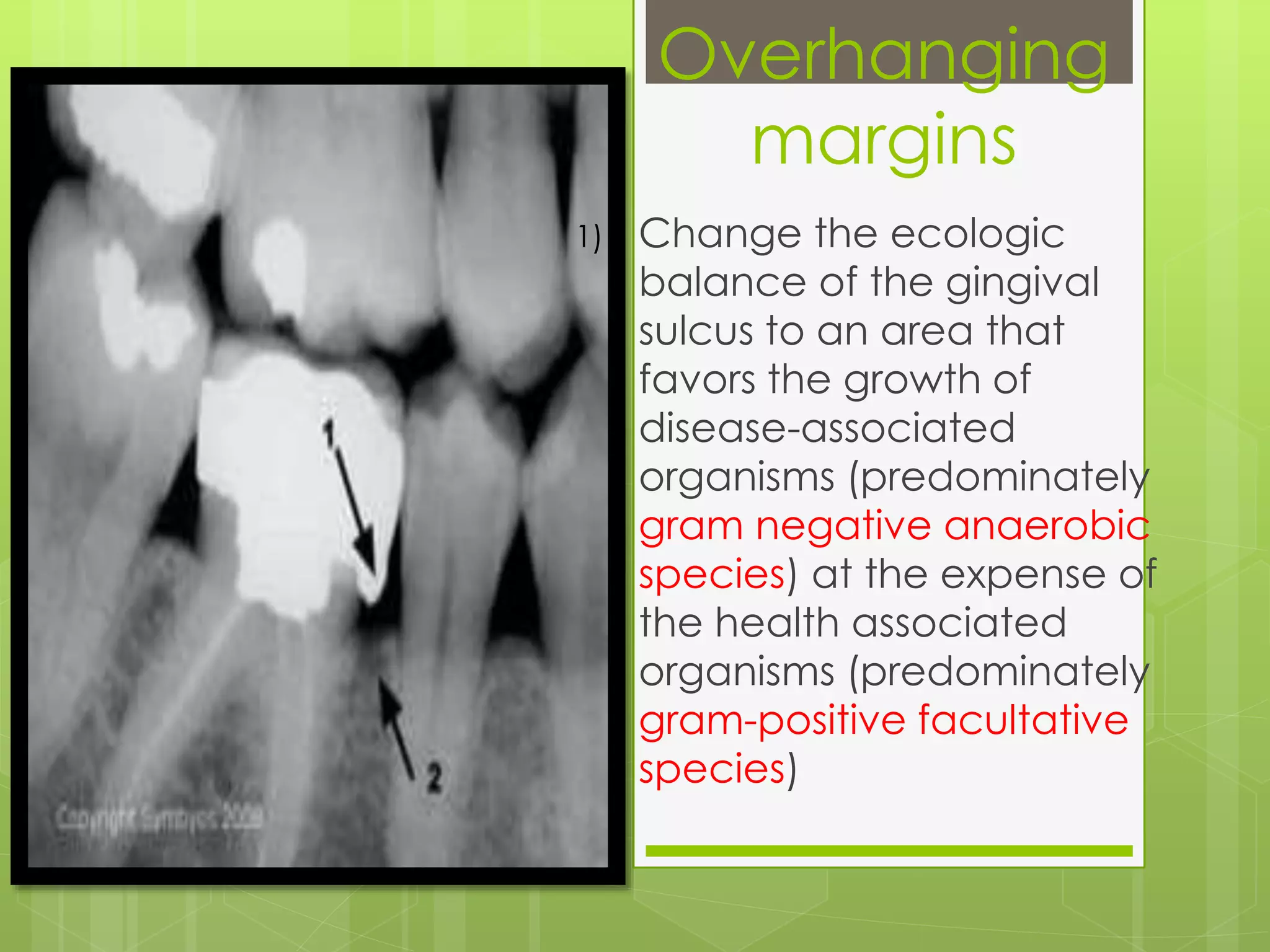 Iatrogenic factors in periodontal disease | PPTX