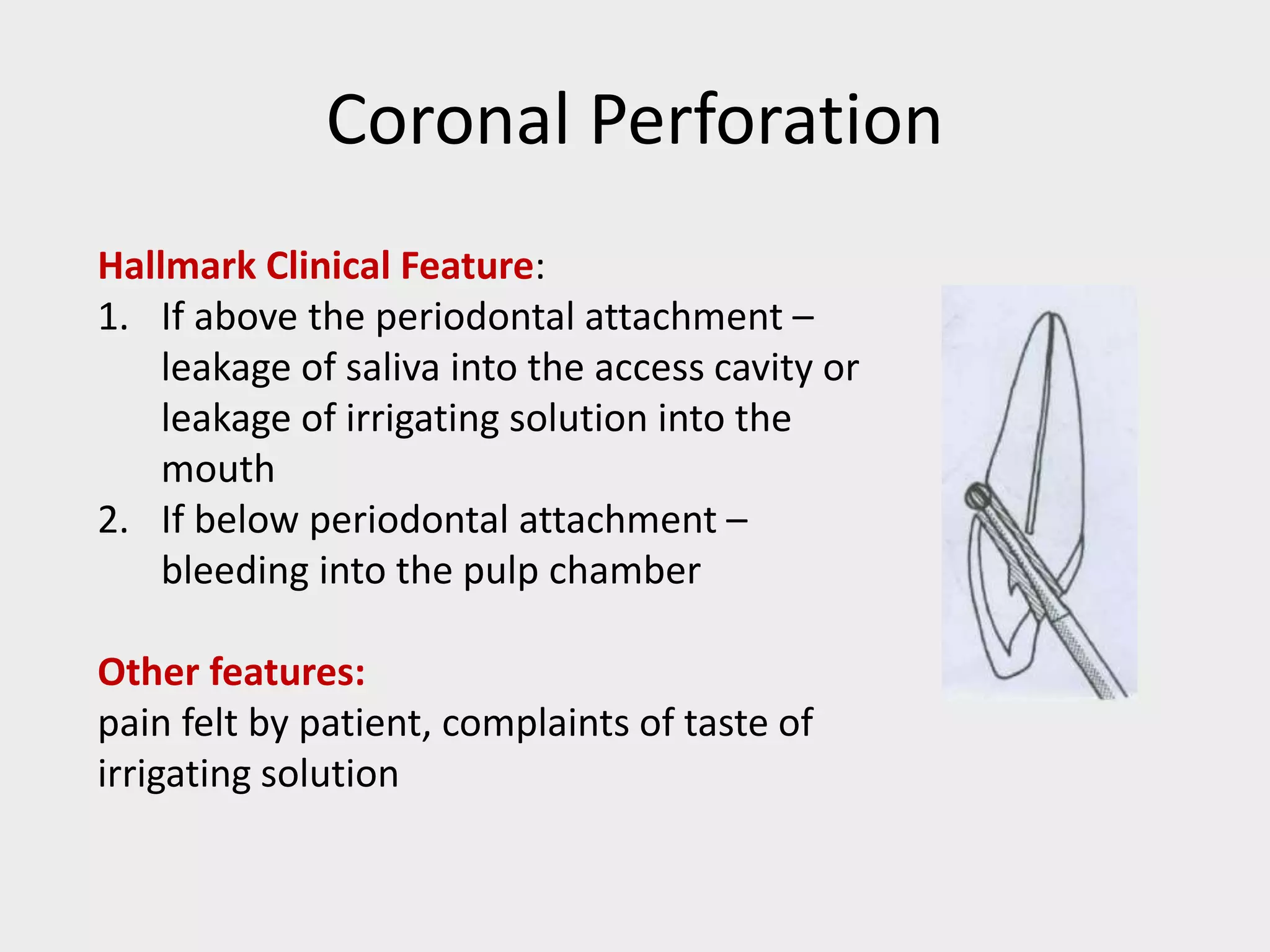 Iatrogenic Perforation- A guide to fixing the hole in your patient's ...