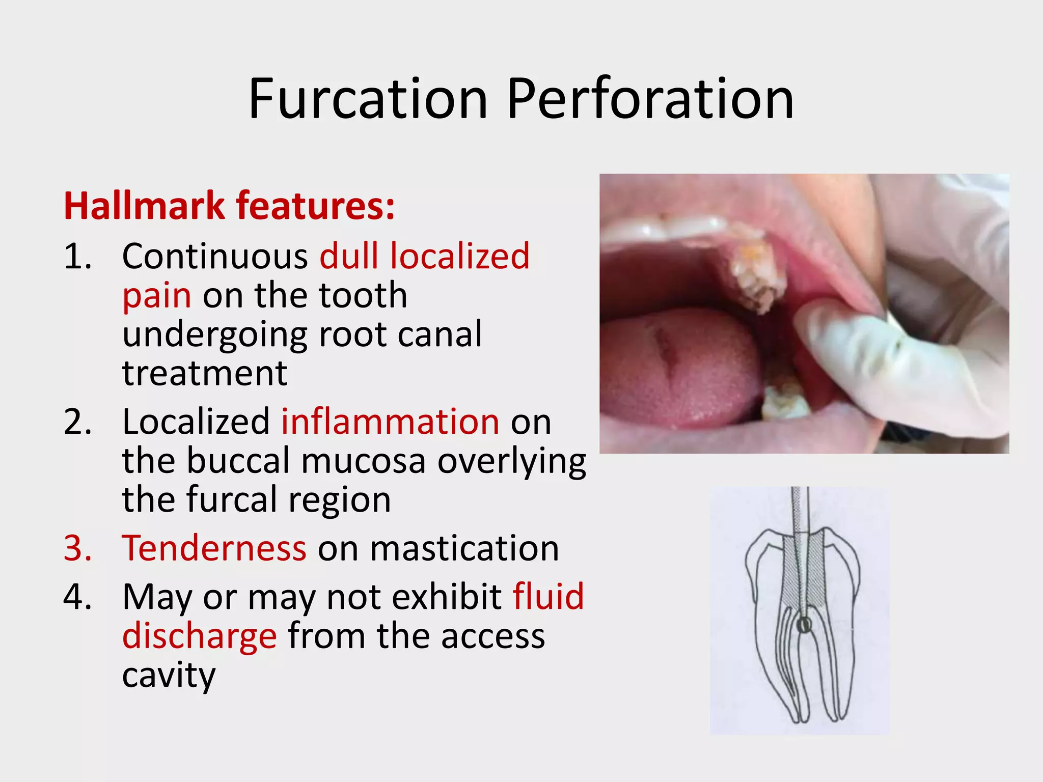 Iatrogenic Perforation- A guide to fixing the hole in your patient's ...