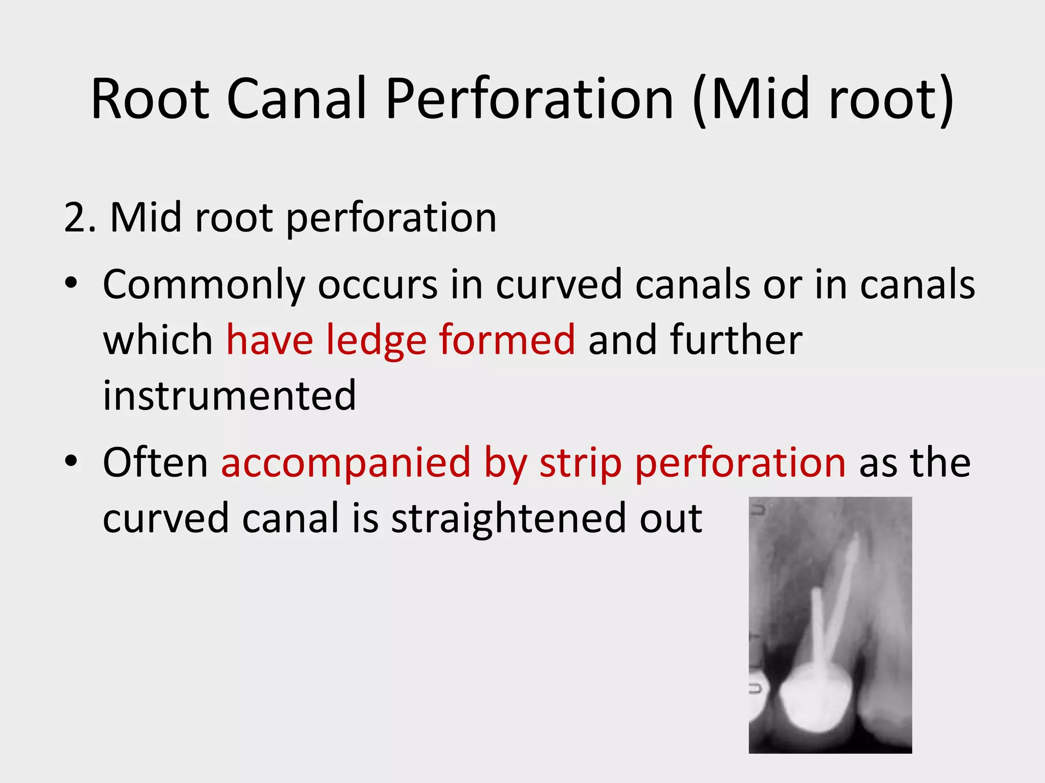 Iatrogenic Perforation- A guide to fixing the hole in your patient's ...