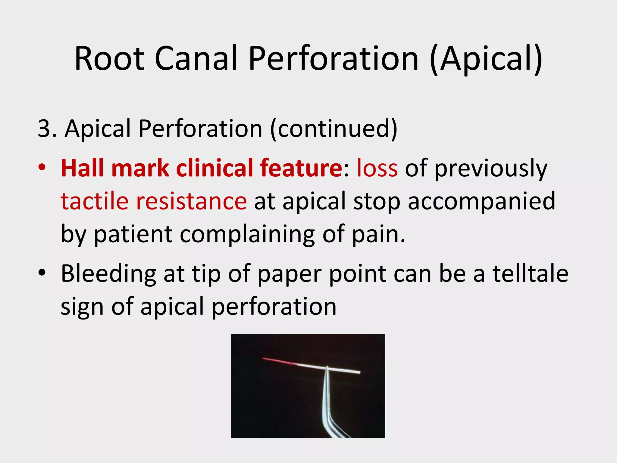 Iatrogenic Perforation- A guide to fixing the hole in your patient's ...