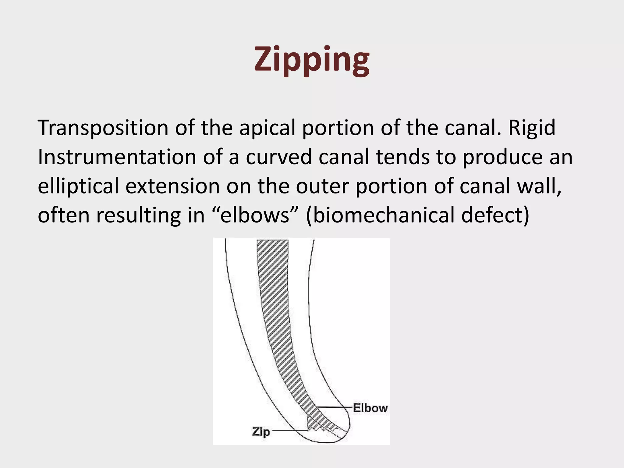 Iatrogenic Perforation- A guide to fixing the hole in your patient's ...