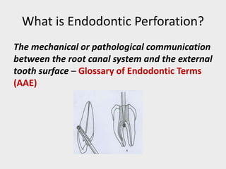 Iatrogenic Perforation- A guide to fixing the hole in your patient's ...