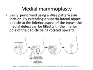 ONCOPLASTIC_BREAST_SURGERY.pptx