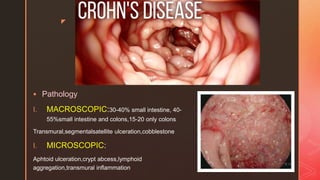 IBD-1.pptx