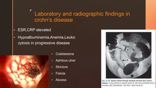 IBD-1.pptx
