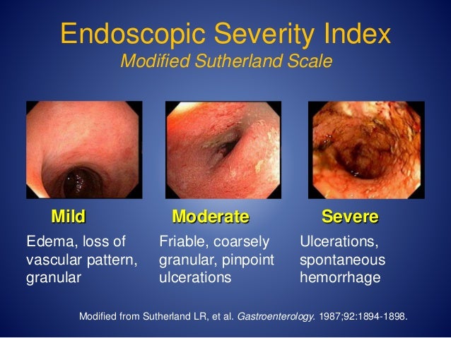 Ulcerative colitis colonoscopy findings - Troscamping