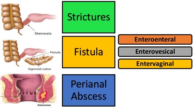 inflammatory Bowel disease