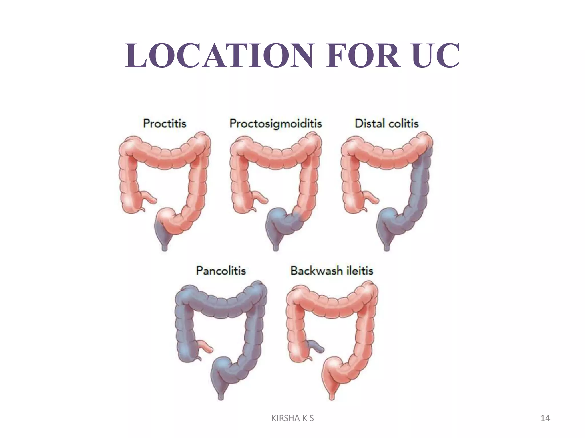 Inflammatory Bowel Disease | PDF | Digestive Disorders | Diseases and ...
