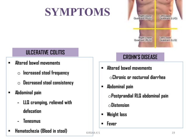 Inflammatory Bowel Disease | PDF | Digestive Disorders | Diseases and ...