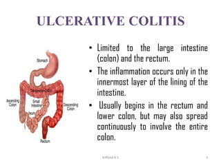 Inflammatory Bowel Disease | PDF