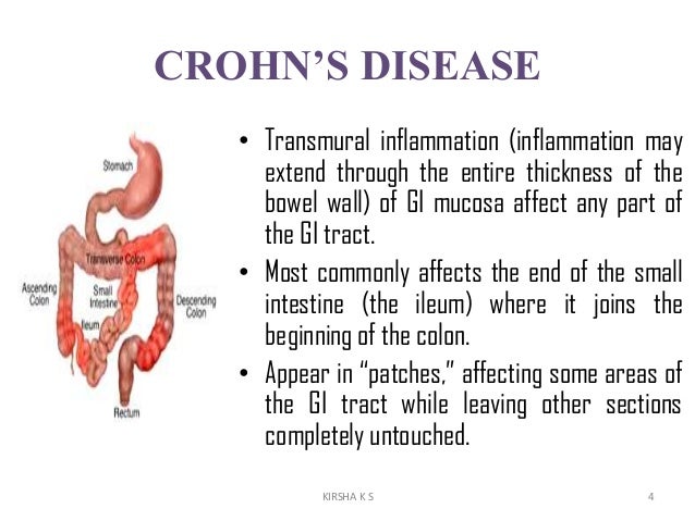 Inflammatory Bowel Disease