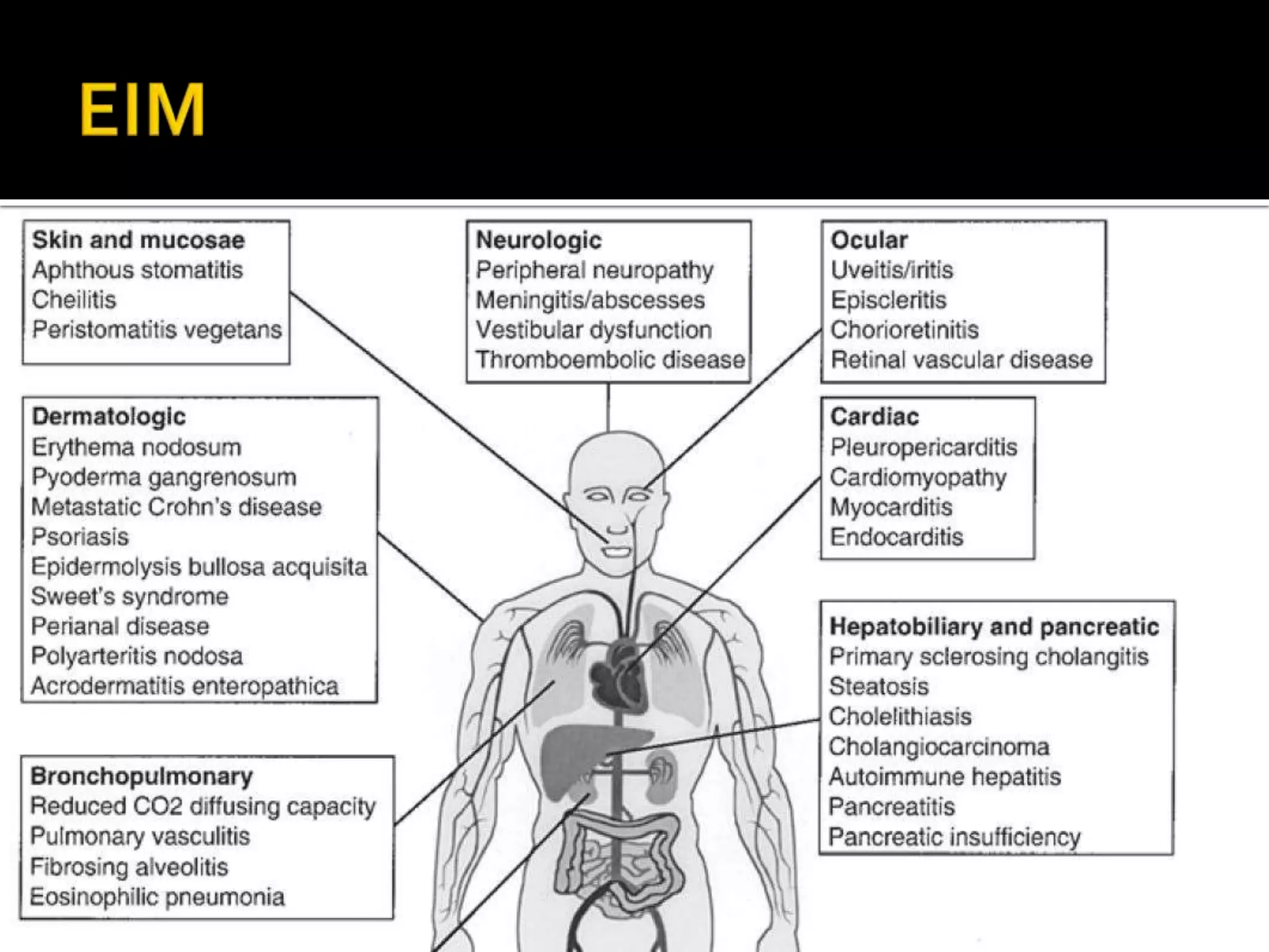 Extraintestinal Manifestations OF IBD Inflammatory Bowel Disease : A ...