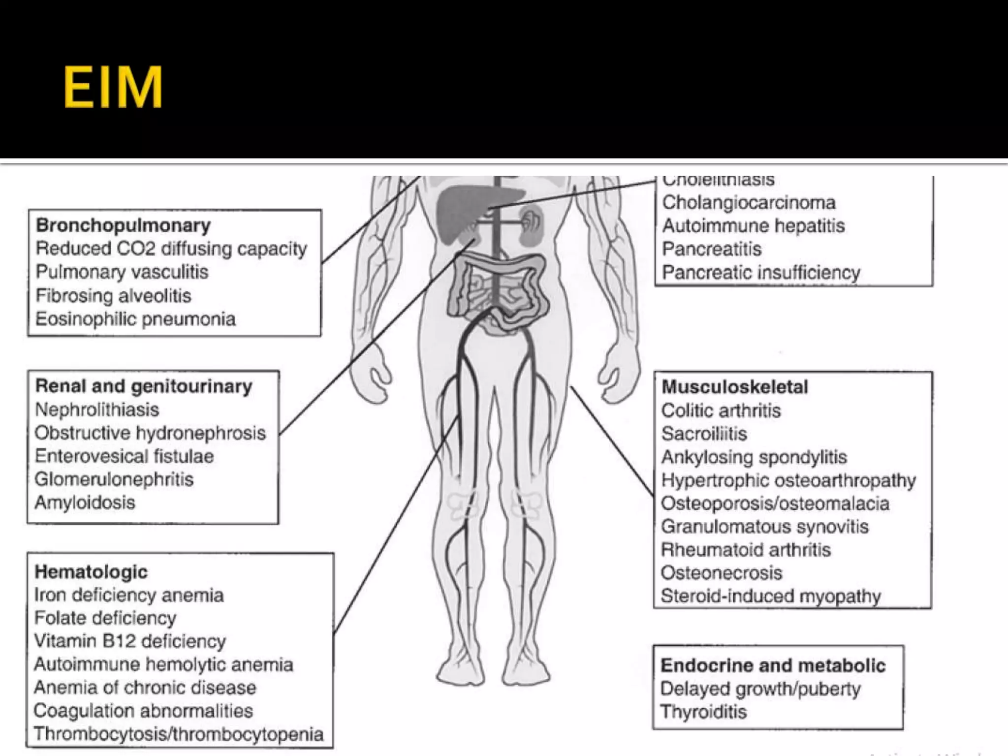 Extraintestinal Manifestations OF IBD Inflammatory Bowel Disease : A ...