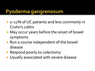 Extraintestinal Manifestations OF IBD Inflammatory Bowel Disease : A ...