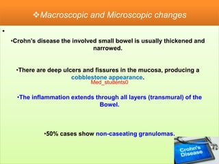 Inflammatory bowel disease | PPTX | Digestive Disorders | Diseases and ...