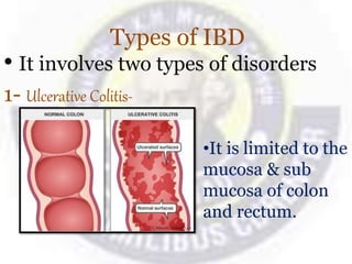 Inflammatory Bowel Disease | PPT