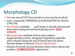 Ibd ulcerative colitis and crohn's disease | PPTX