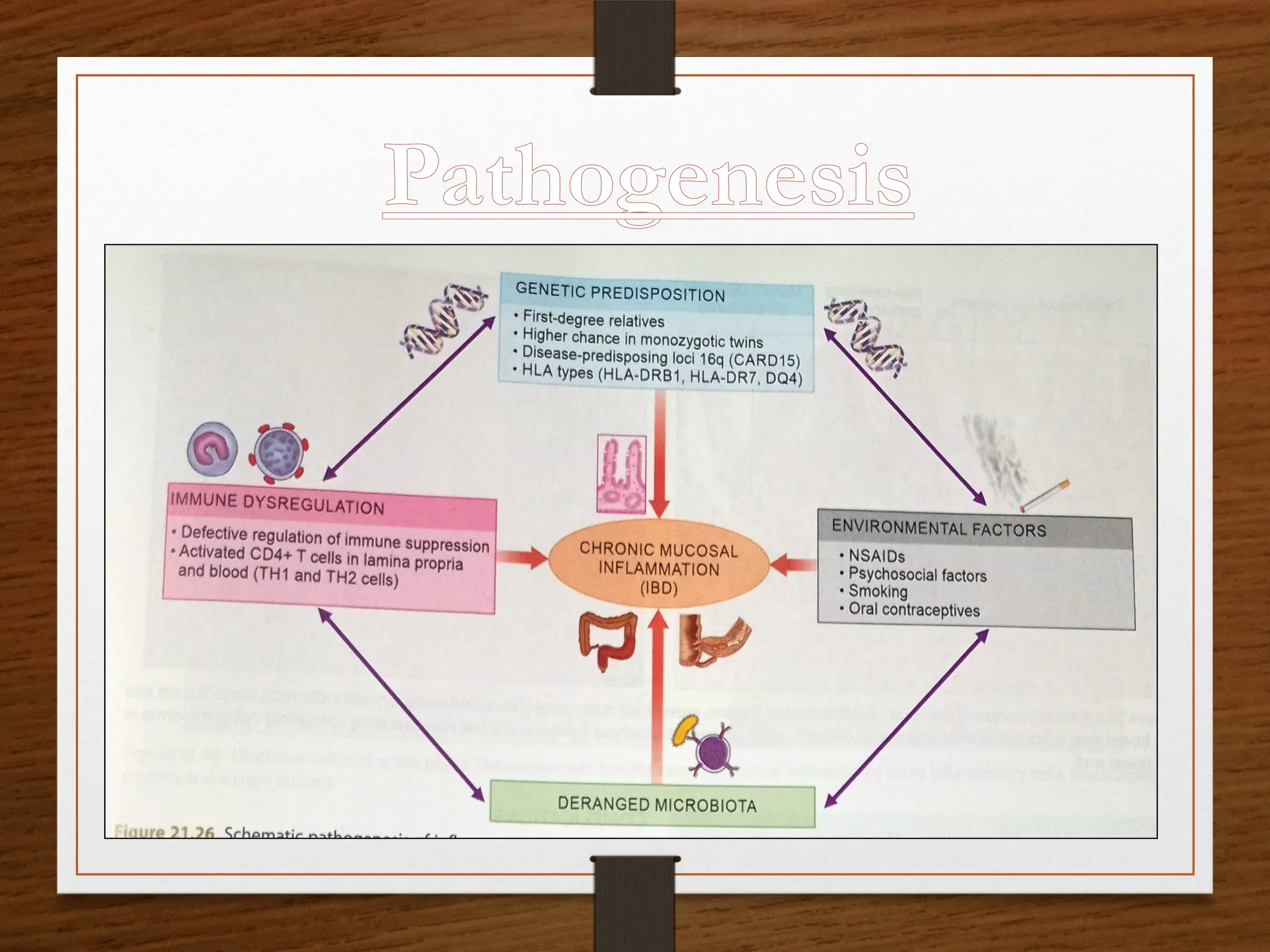 Inflammatory Bowel Disease- Crohns vs UC | PPTX