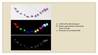 IBD-AI JC AI in pathology for determining inflammatory bowel disease | PPT