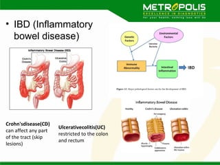 Laboratory investigations in inflammatory bowel disease | PPT