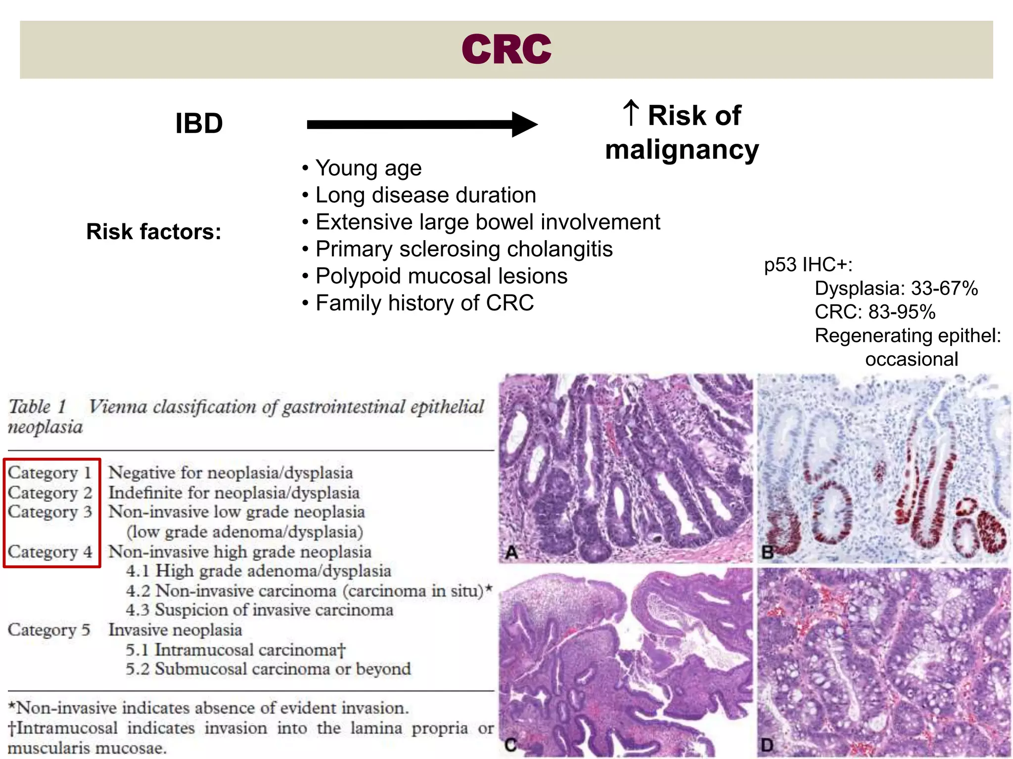 Inflammatory Bowel Disease (IBD) Histopathology | PPTX