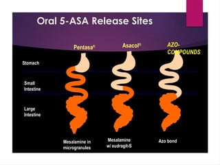 Inflammatory Bowel Disease-Flares & Management | PPT