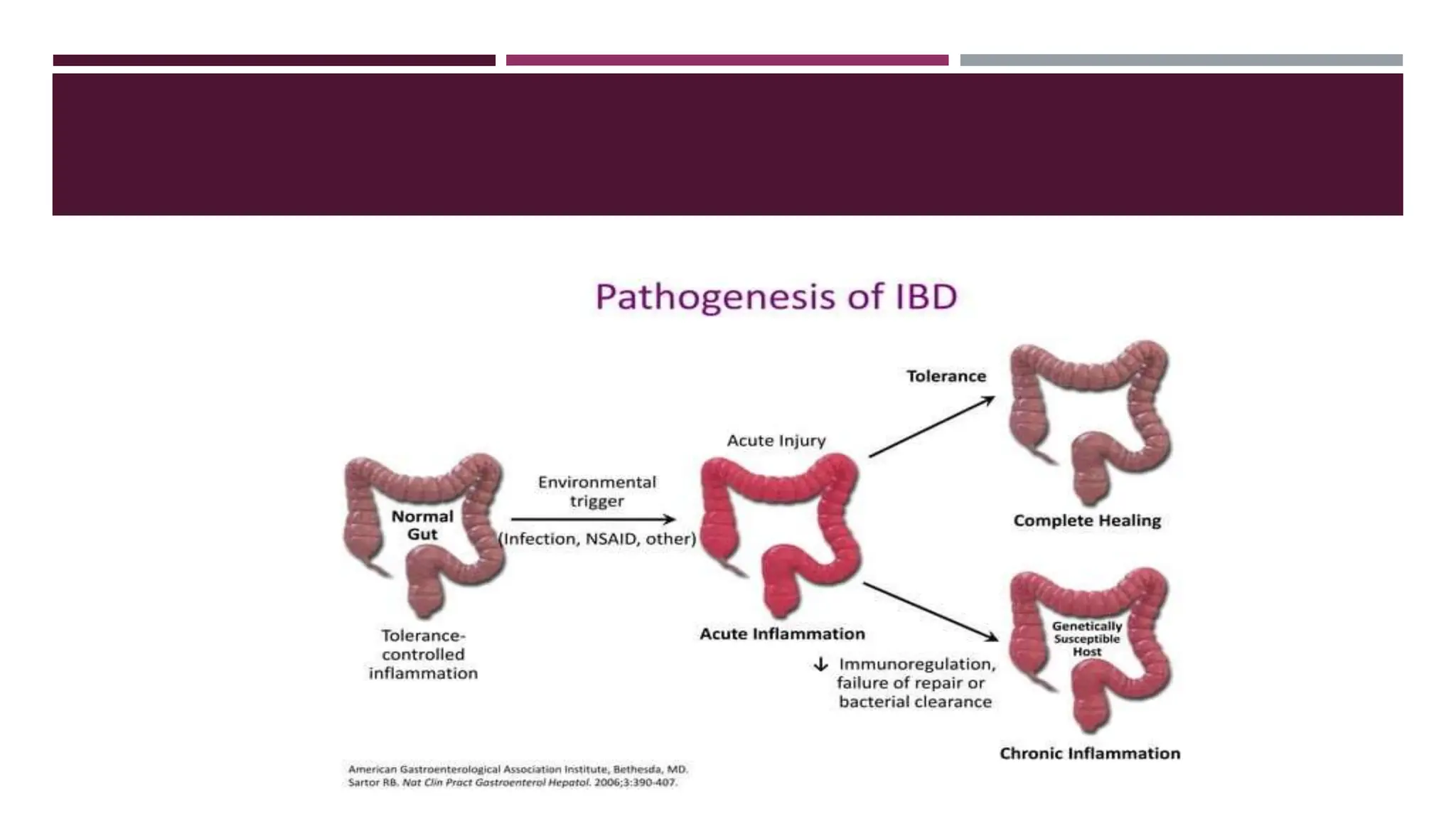 IBD and ulcerative colitis for the science | PPT