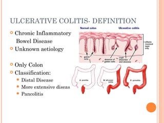 Inflammatory Bowel Disease | PPT | Digestive Disorders | Diseases and ...