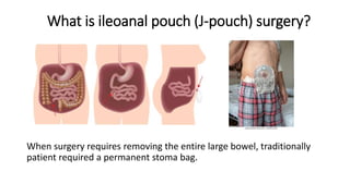 IBD centre CW+ sponsors.pptx