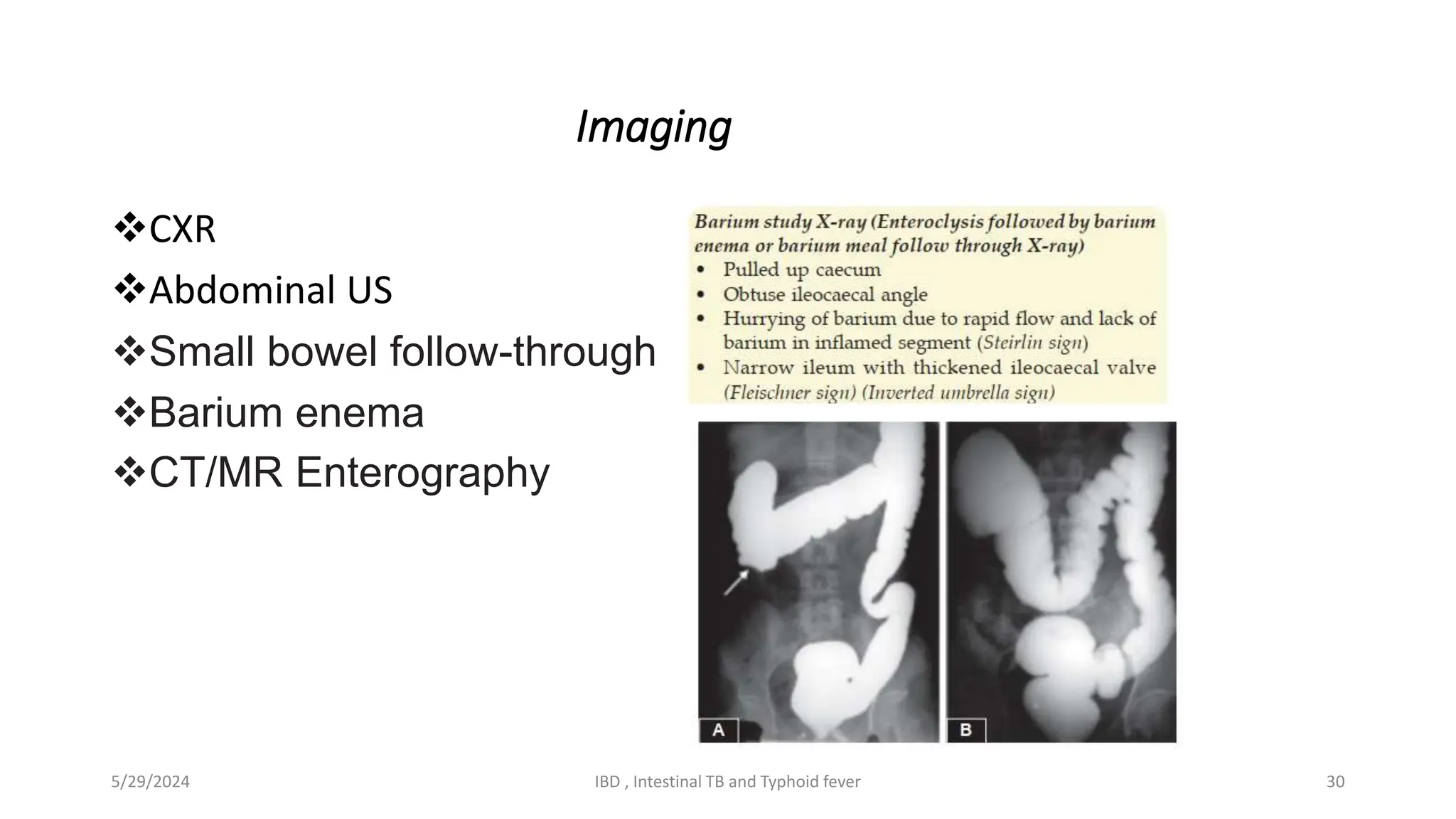 IBD, Intestinal TB and Typhoid fever.pptx