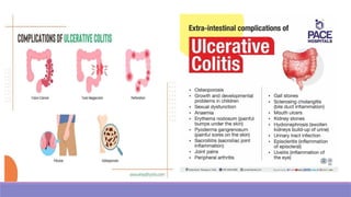IBD- Inflammatory bowel disease. 2 types - ulcerative colitis and crohn ...