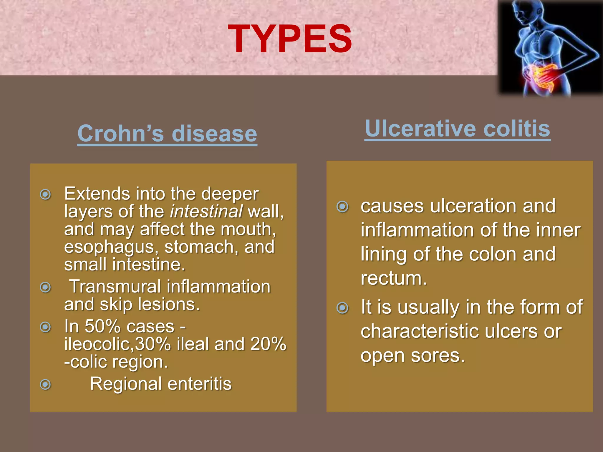 INFLAMMATORY BOWEL DISEASE | PPTX