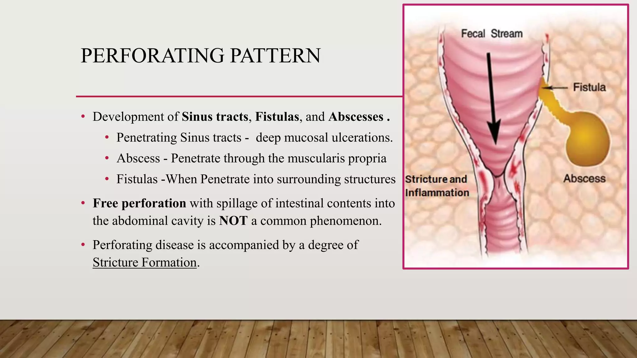 Inflammatory Bowel Disease | PPTX