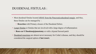 Inflammatory Bowel Disease | PPTX