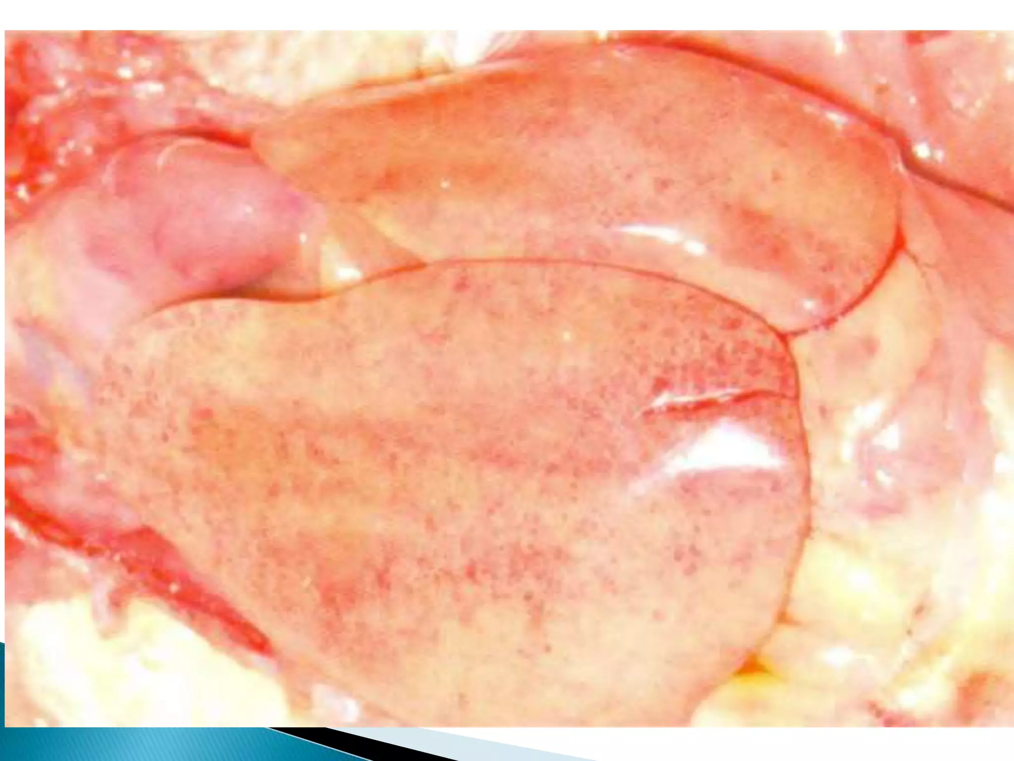 IBH, HPS in poultry | PPTX