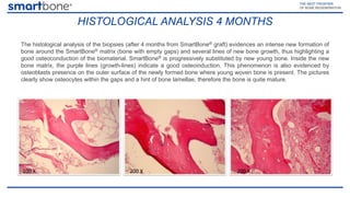 Block technique using SmartBone | PPT