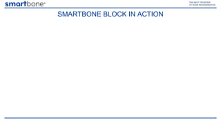 SmartBone: the innovative bone substitute for oral surgery and ...