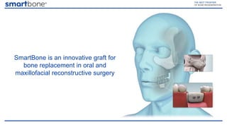 SmartBone: the innovative bone substitute for oral surgery and maxillofacial surgery | PPT