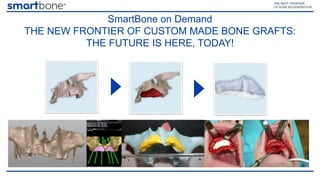 SmartBone: the innovative bone substitute for oral surgery and ...