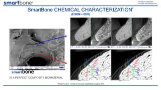 SmartBone: the innovative bone substitute for oral surgery and ...