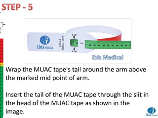 MUAC Tape an Introduction, How to Use MUAC tape ? | PPTX