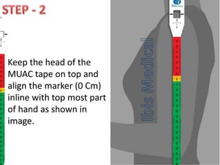 MUAC Tape an Introduction, How to Use MUAC tape ? | PPTX