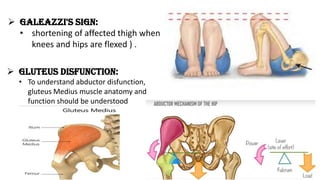 Ibn Sina College L11-Developmental dysplasia Of Hip.pdf