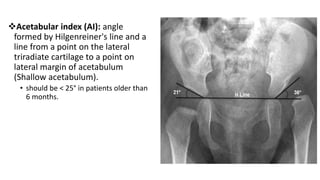 Ibn Sina College L11-Developmental dysplasia Of Hip.pdf