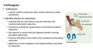 Ibn Sina College L11-Developmental dysplasia Of Hip.pdf