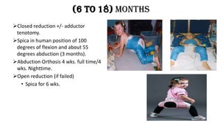 Ibn Sina College L11-Developmental dysplasia Of Hip.pdf