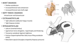 Ibn Sina College L11-Developmental dysplasia Of Hip.pdf