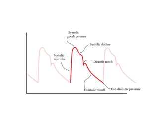 Invasive Blood pressure monitoring presentation | PPTX
